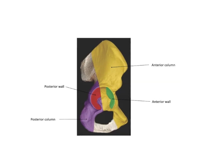 IMAGING AND CLASSIFICATION OF ACETABULAR FRACTURES.pptx