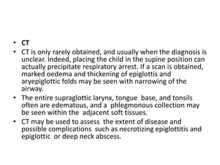Imaging and pathology of larynx (2) | PPTX