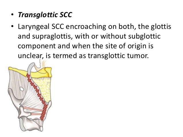 Imaging and pathology of larynx (2)