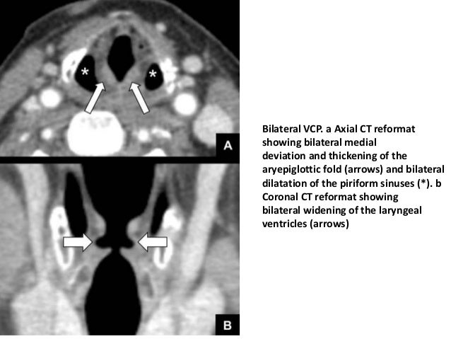 Imaging and pathology of larynx (2)