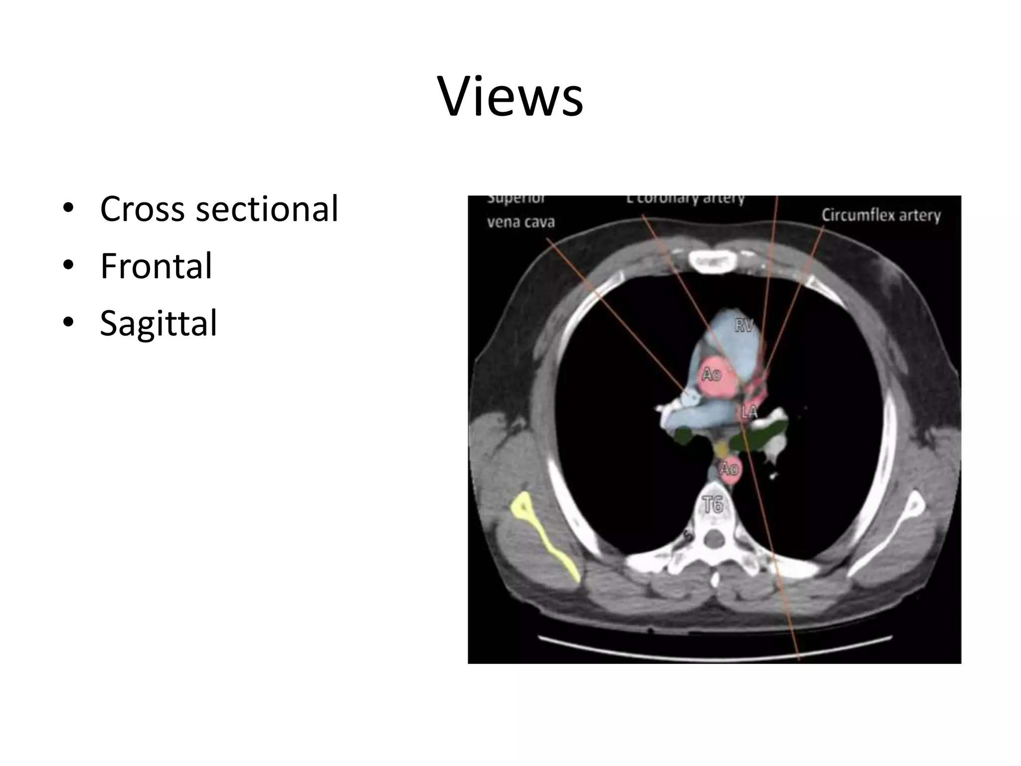 Interpretation Of Chest Ct Ppt