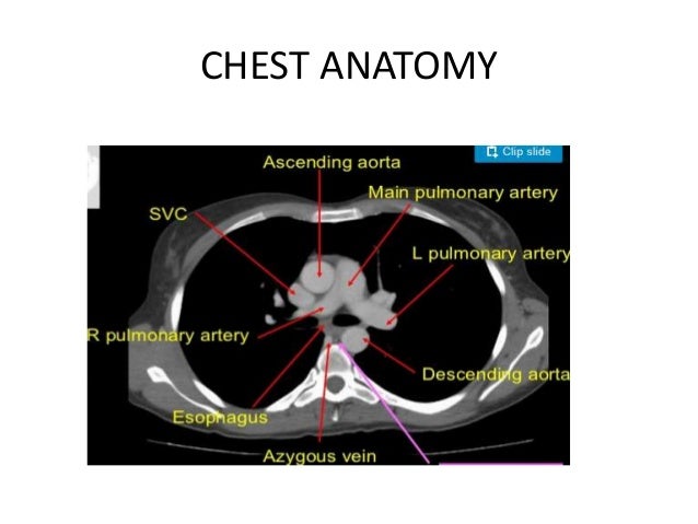 Interpretation of chest CT