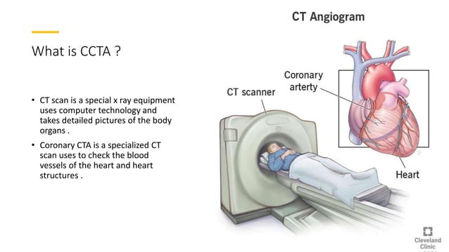IMAGING CT CORONARY.pptx