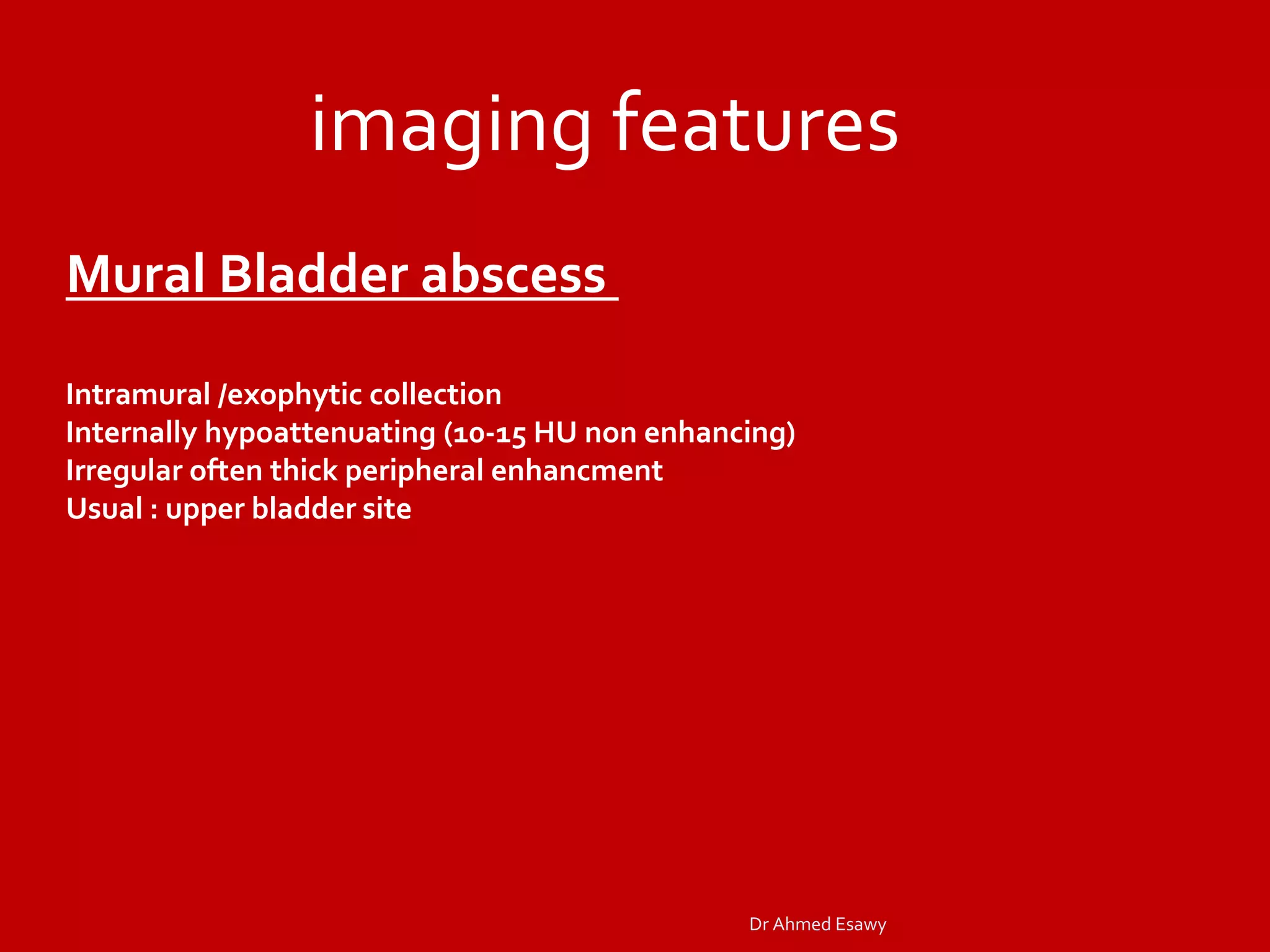 Imaging cystitis Dr Ahmed Esawy | PDF