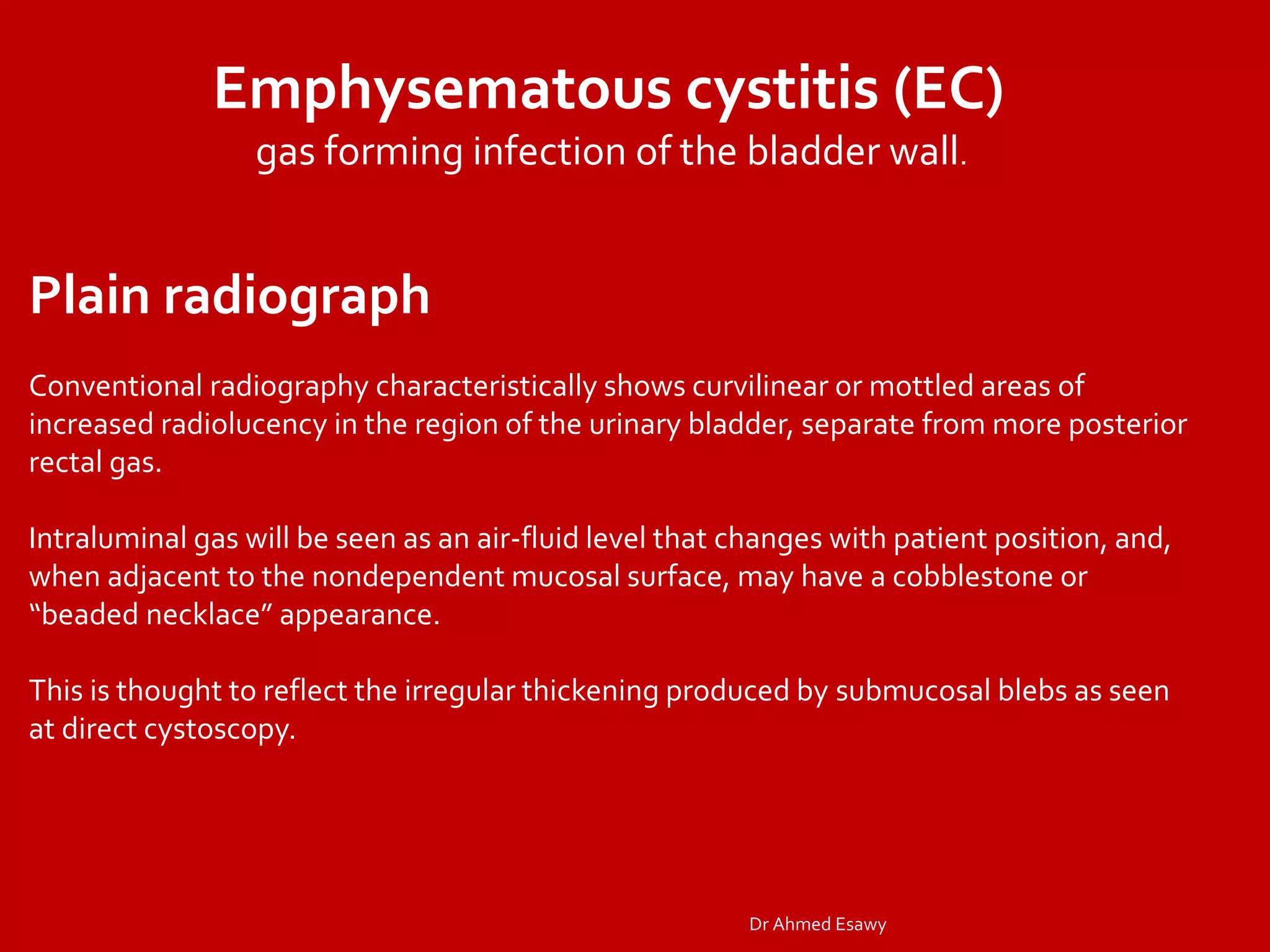 Imaging cystitis Dr Ahmed Esawy | PDF