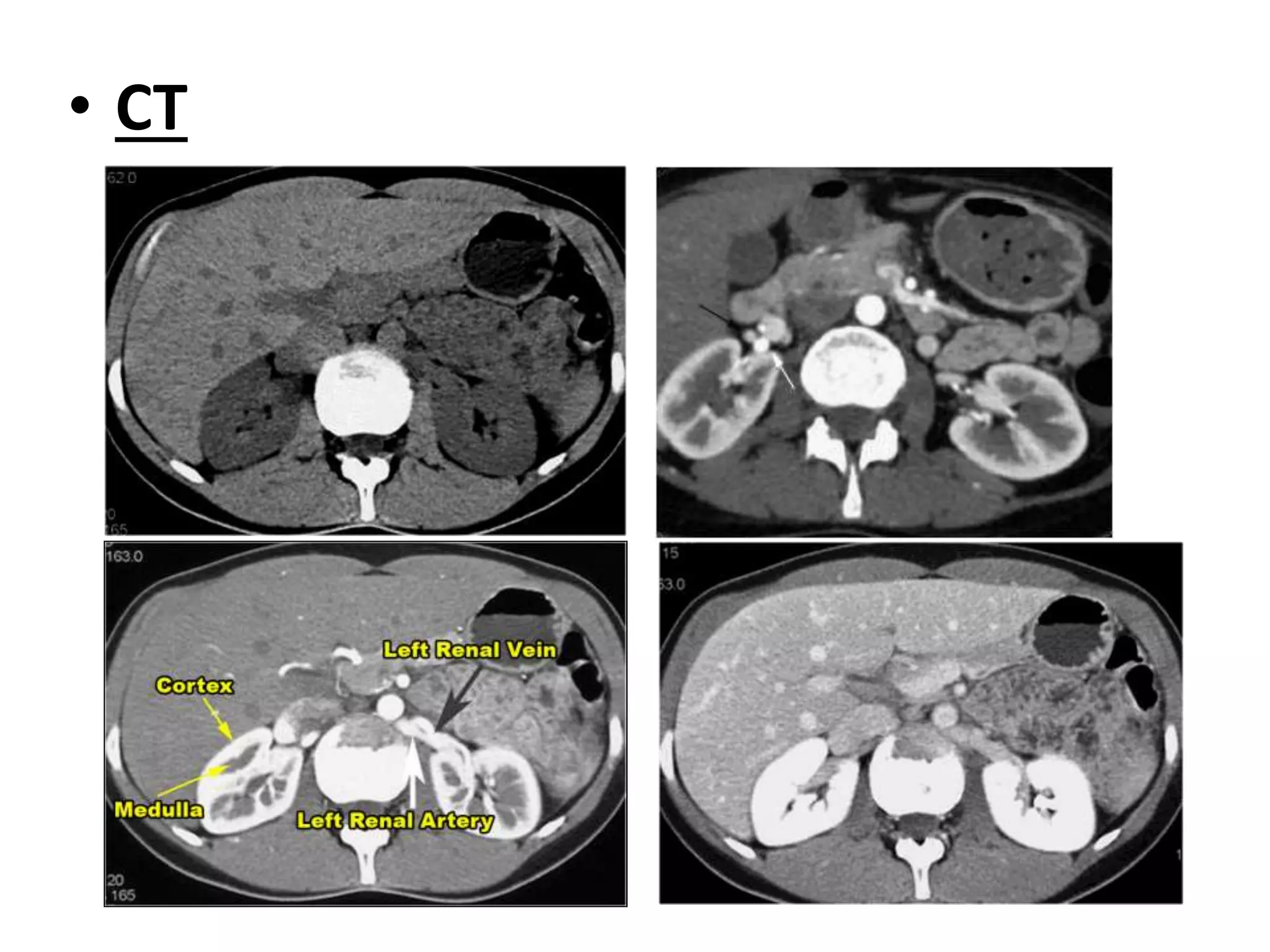 Imaging endocrine and gu copy | PPTX