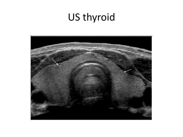 Imaging endocrine and gu copy | PPTX