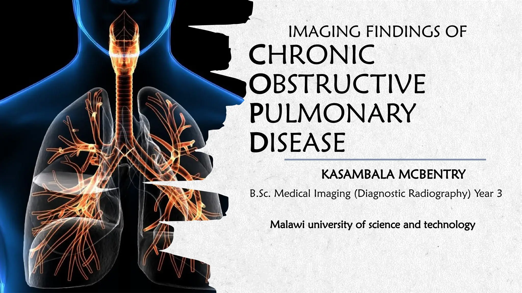 Radiographic Imaging findings of COPD on Conventional X-ray and CT | PPTX