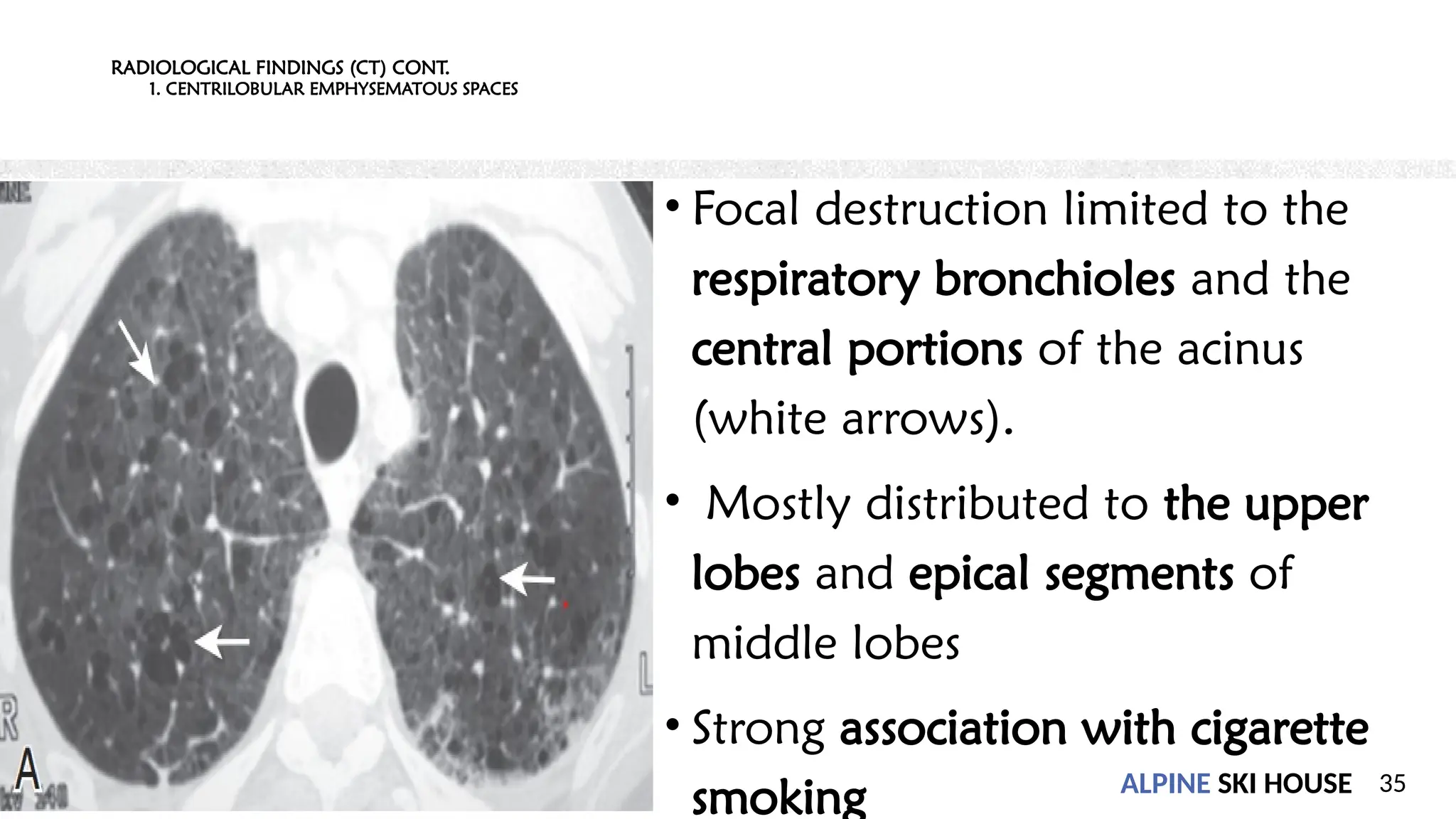 Radiographic Imaging findings of COPD on Conventional X-ray and CT | PPTX
