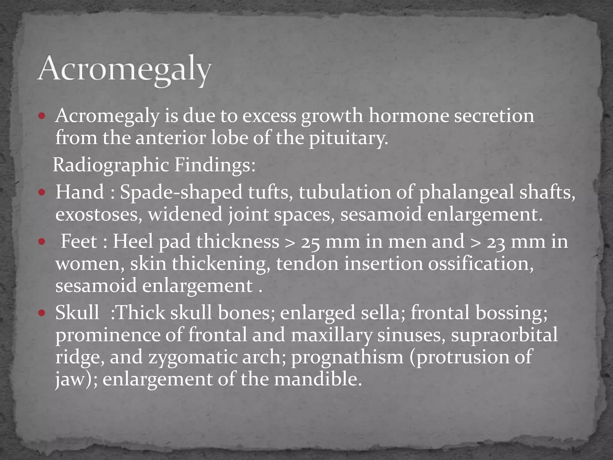 Imaging findings of metabolic bone diseases | PPTX