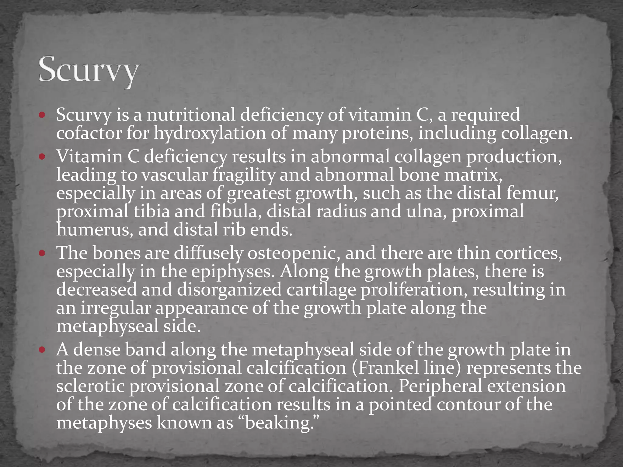 Imaging findings of metabolic bone diseases | PPTX