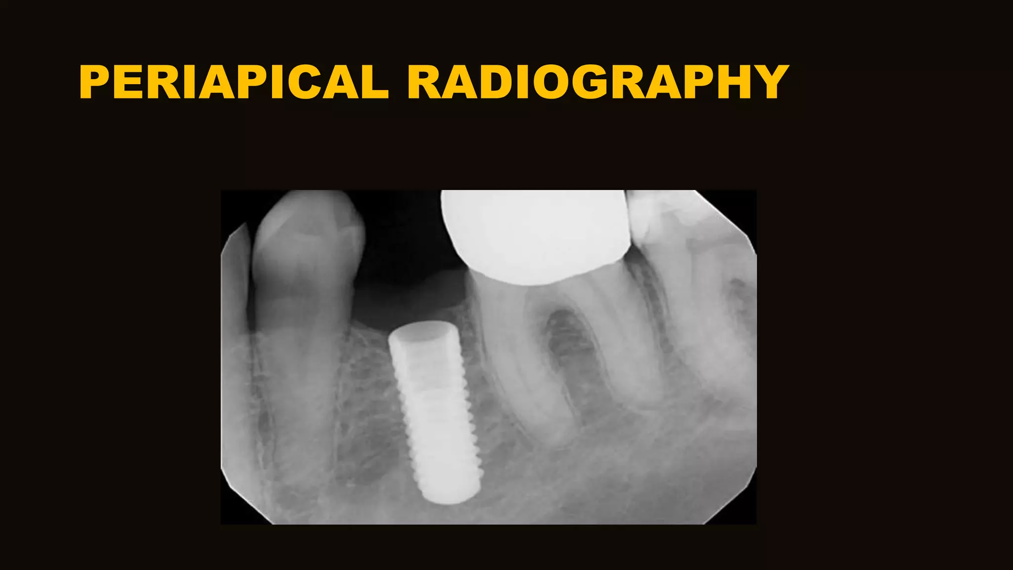 Imaging Modalities in Dental Implant | PPTX