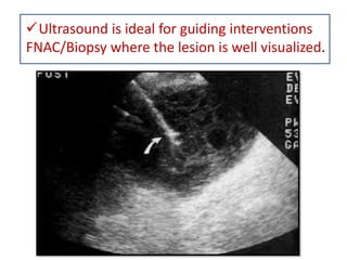 Imaging HNF(head neck and face) -cancer | PPTX