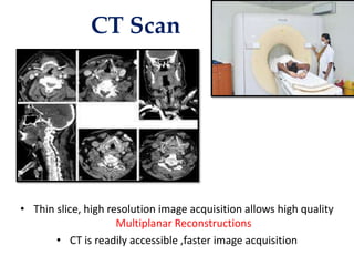 Imaging HNF(head neck and face) -cancer | PPTX