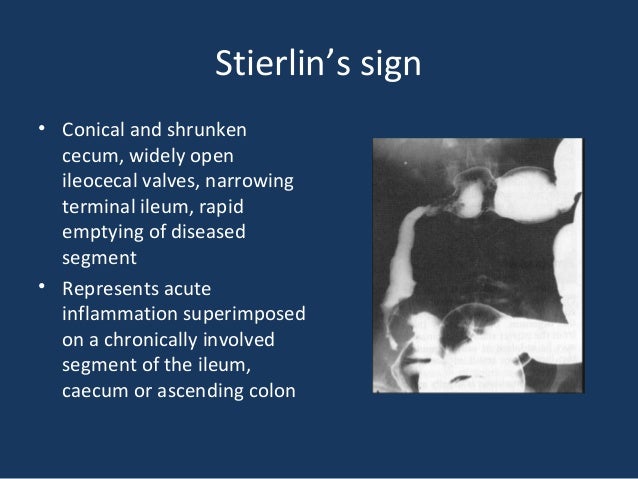 IMAGING IN ABDOMINAL TUBERCULOSIS