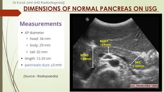 Imaging in Acute Pancreatitis | PPTX