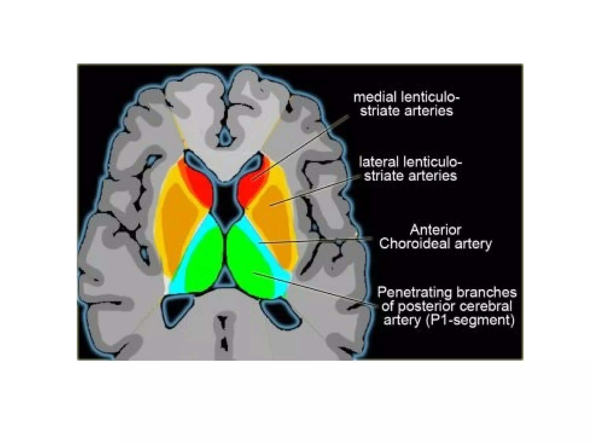 Imaging In Acute Stroke Ppt