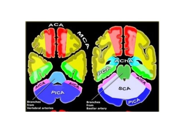 Imaging In Acute Stroke