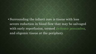 Imaging in acute stroke | PPTX