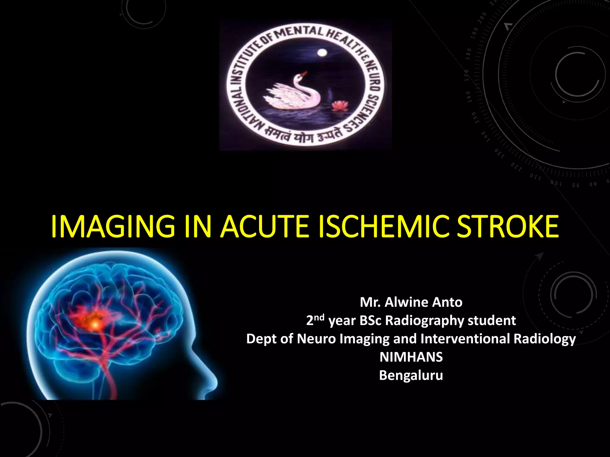 Imaging in acute stroke | PPTX
