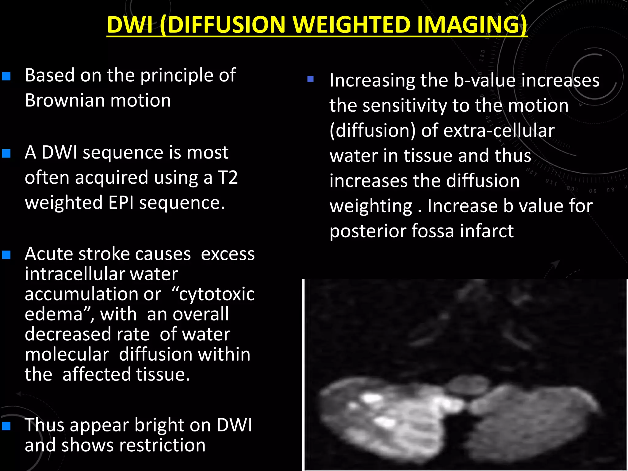 Imaging in acute stroke | PPTX