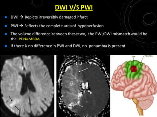 Imaging in acute stroke | PPTX