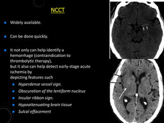 Imaging in acute stroke | PPTX