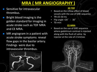 Imaging in acute stroke | PPTX