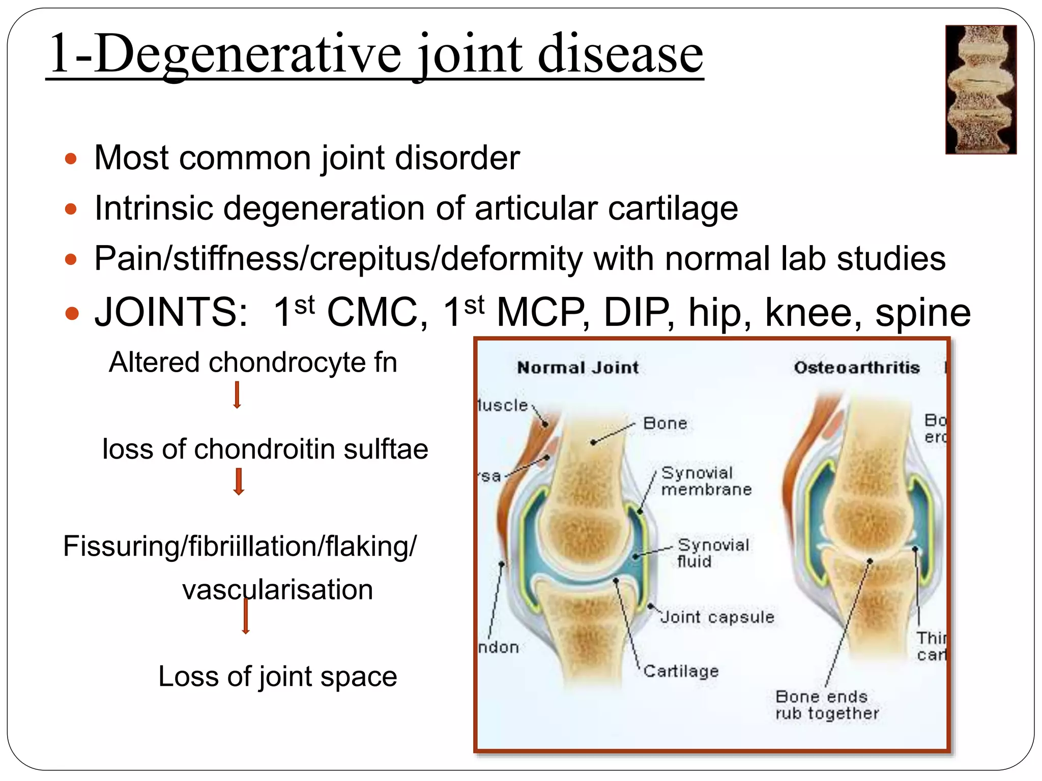 Imaging in arthritis | PPTX