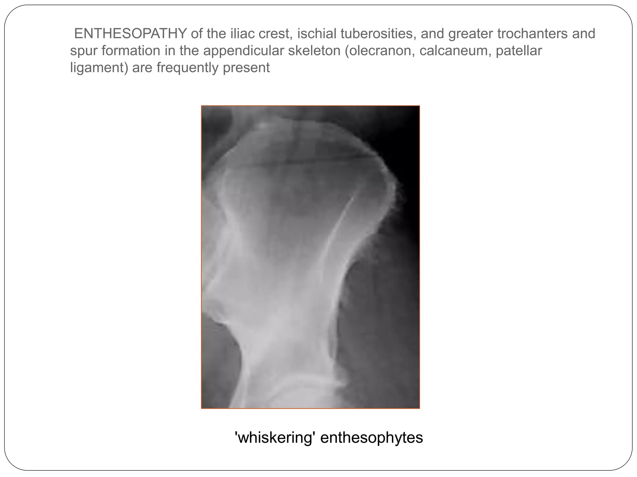 Imaging in arthritis | PPTX