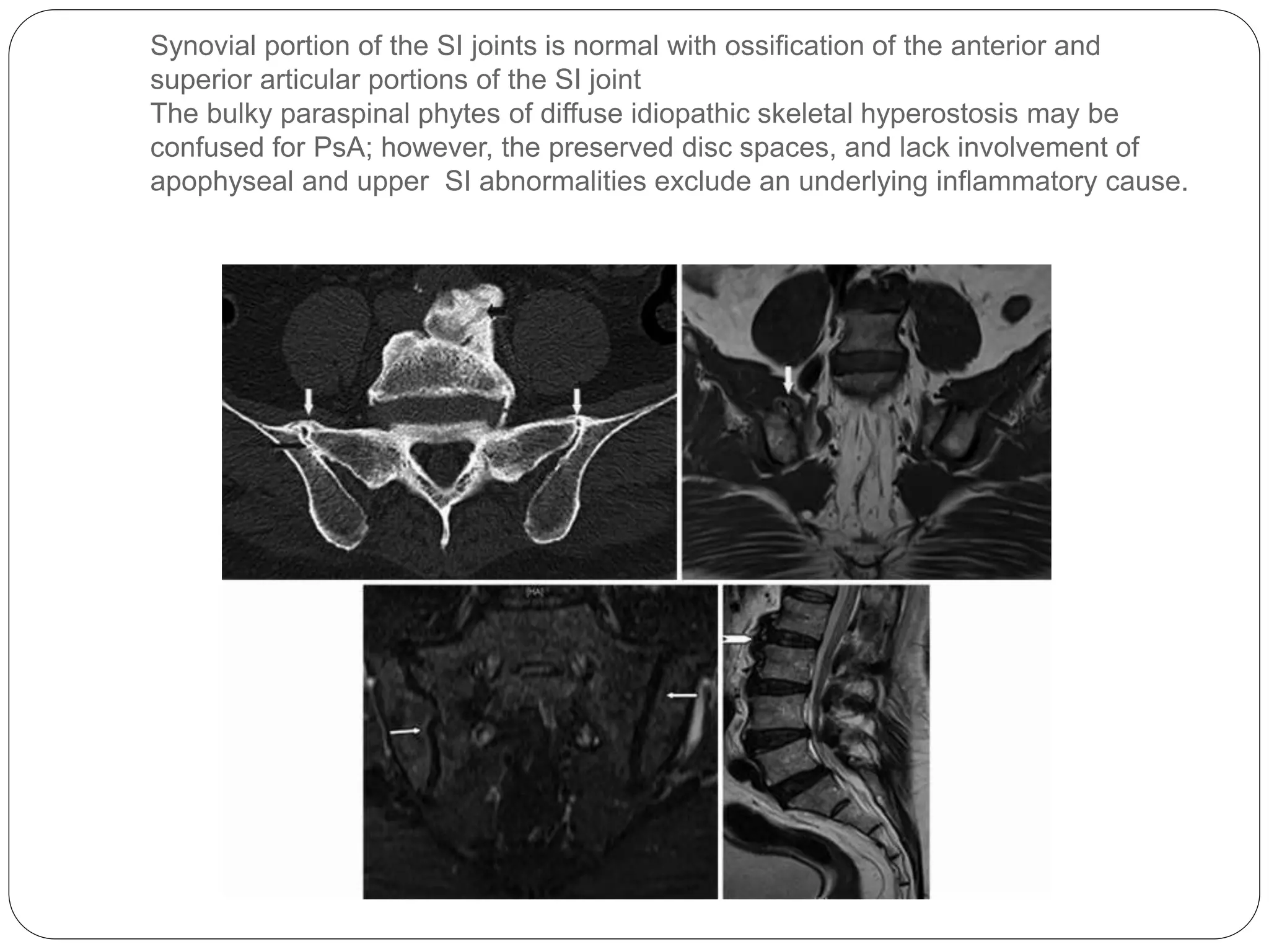 Imaging in arthritis | PPTX