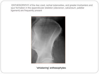 Imaging in arthritis | PPTX