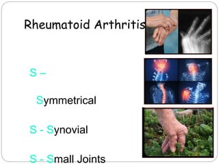 Imaging in arthritis | PPTX