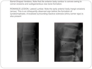 Imaging in arthritis | PPTX