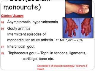 Imaging in arthritis | PPTX