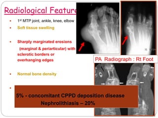 Imaging in arthritis | PPTX