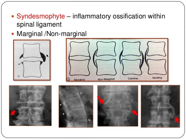 Imaging in arthritis