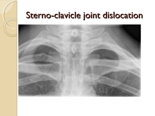 Imaging in chest trauma | PPT