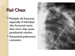 Imaging in chest trauma | PPT