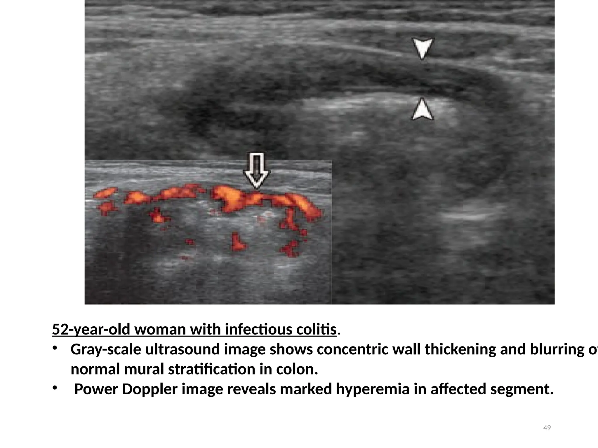 Imaging in colorectal diseases 3.pptx presentation | PPTX