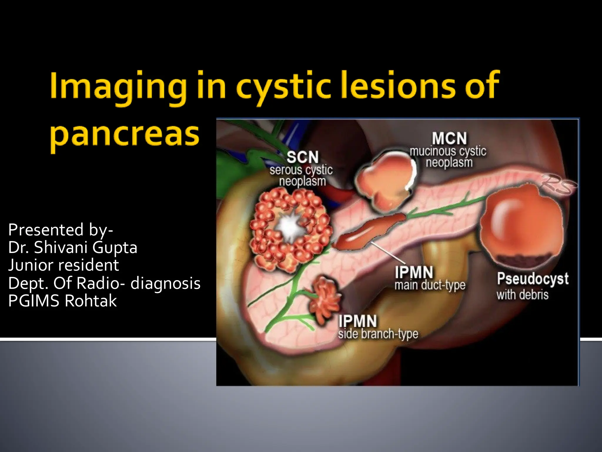 Imaging in cystic lesions of pancreas.pdf
