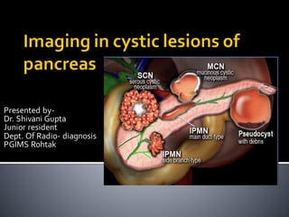 Imaging in cystic lesions of pancreas.pdf