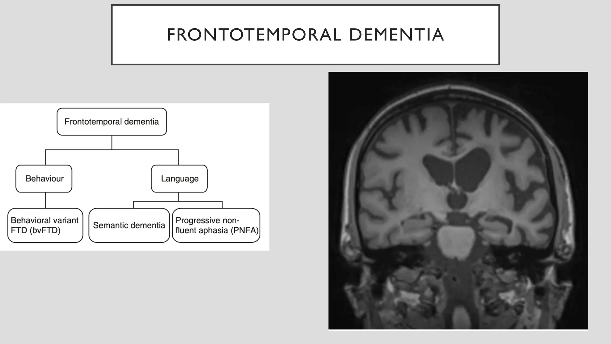 Imaging in Dementia - A Primer for neuroradiologists | PPTX
