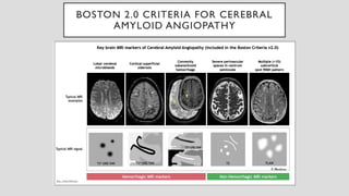 Imaging in Dementia - A Primer for neuroradiologists | PPTX