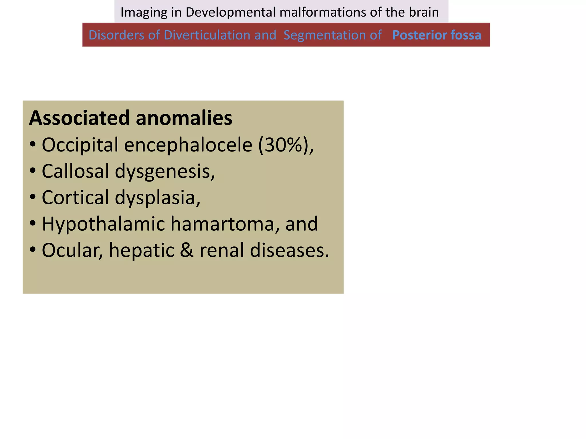 Imaging in developmental malformations of the brain | PPTX