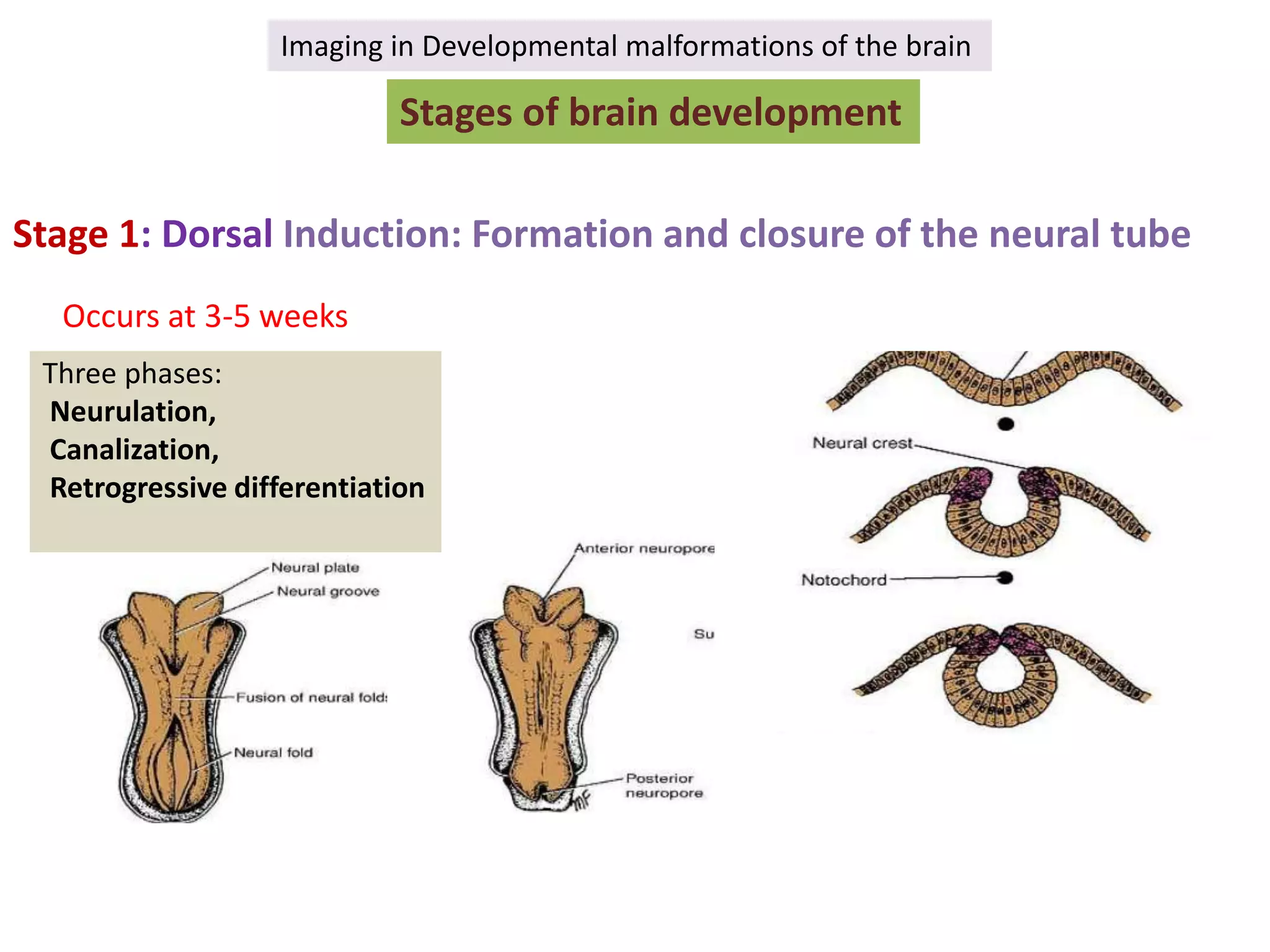 Imaging in developmental malformations of the brain | PPTX