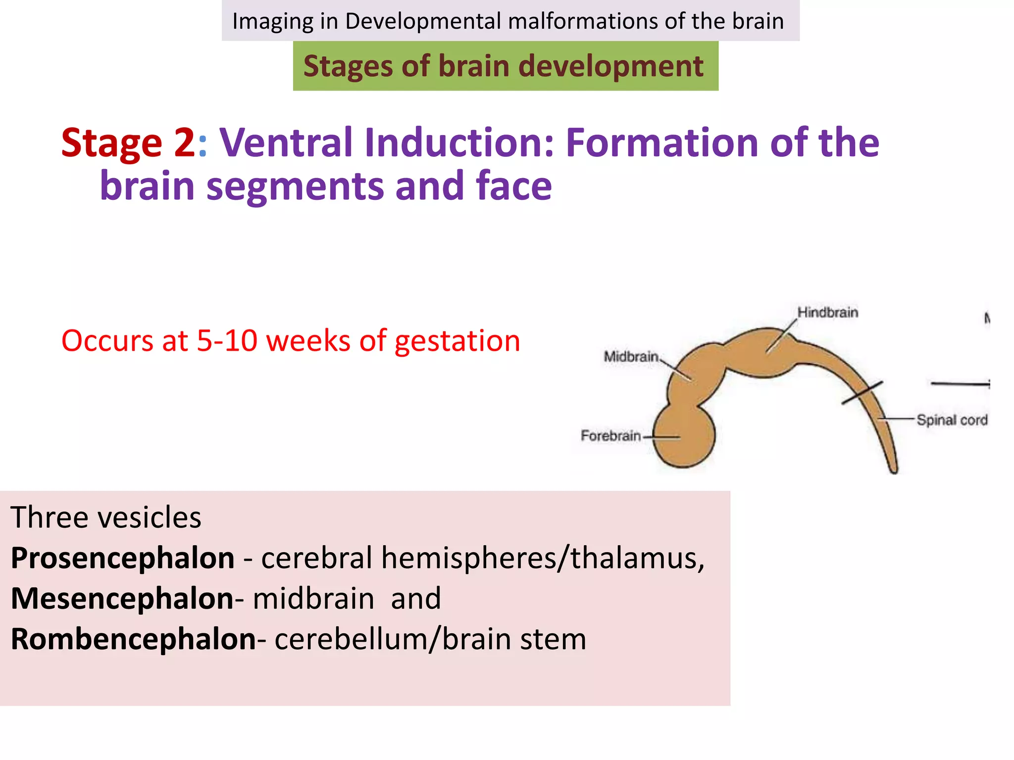 Imaging in developmental malformations of the brain | PPTX