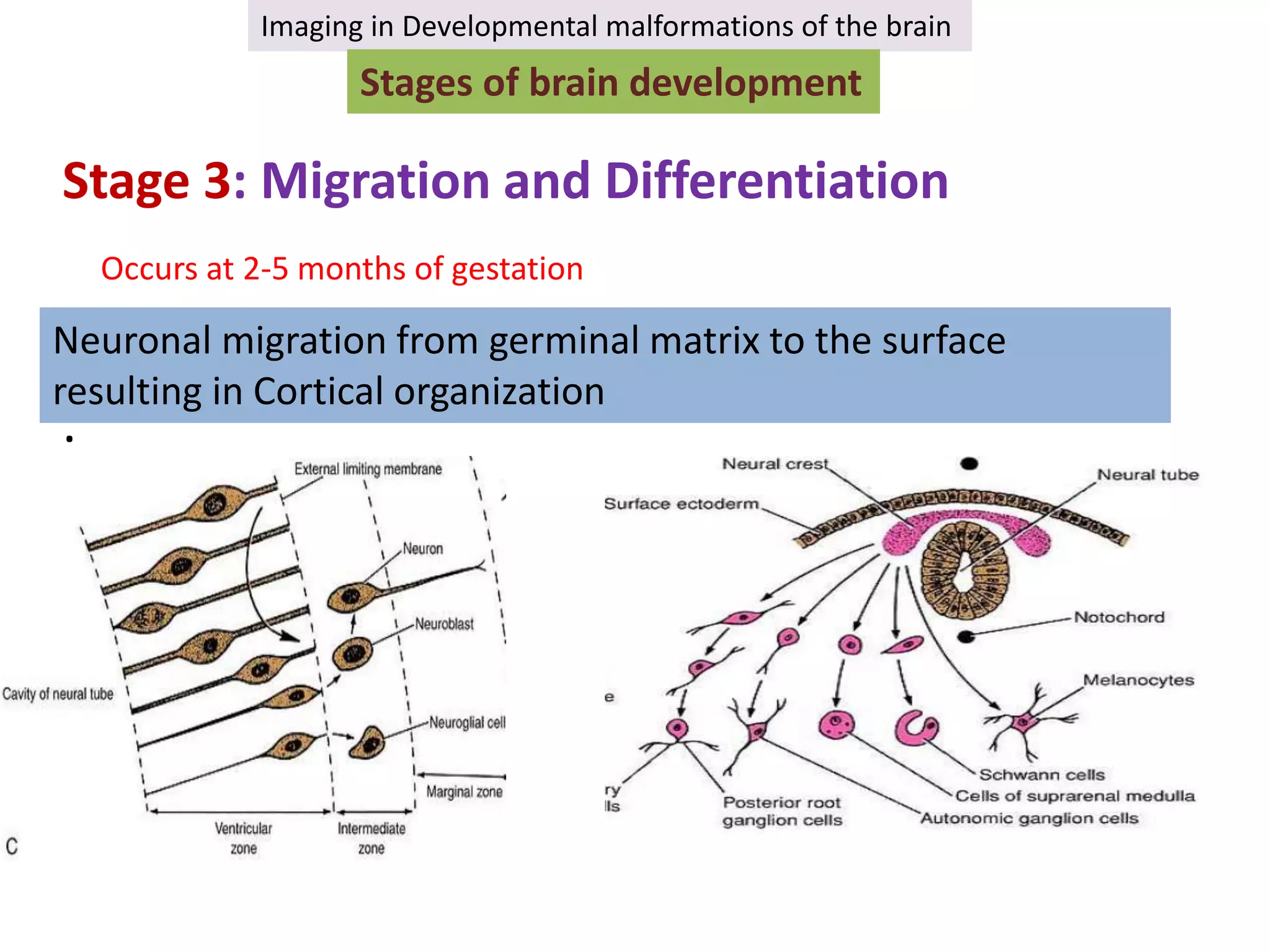 Imaging in developmental malformations of the brain | PPTX
