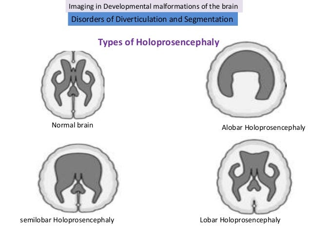 Imaging in developmental malformations of the brain