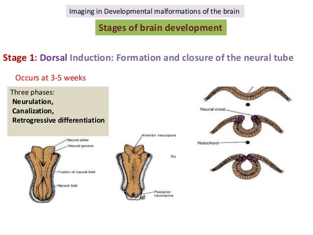 Imaging in developmental malformations of the brain